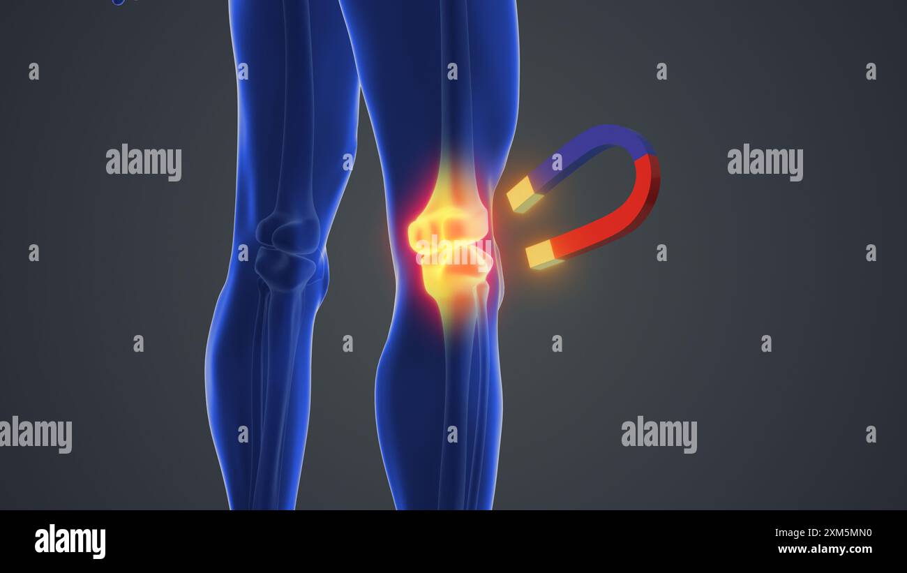 Magnet therapy for knee joint pain Stock Photo - Alamy