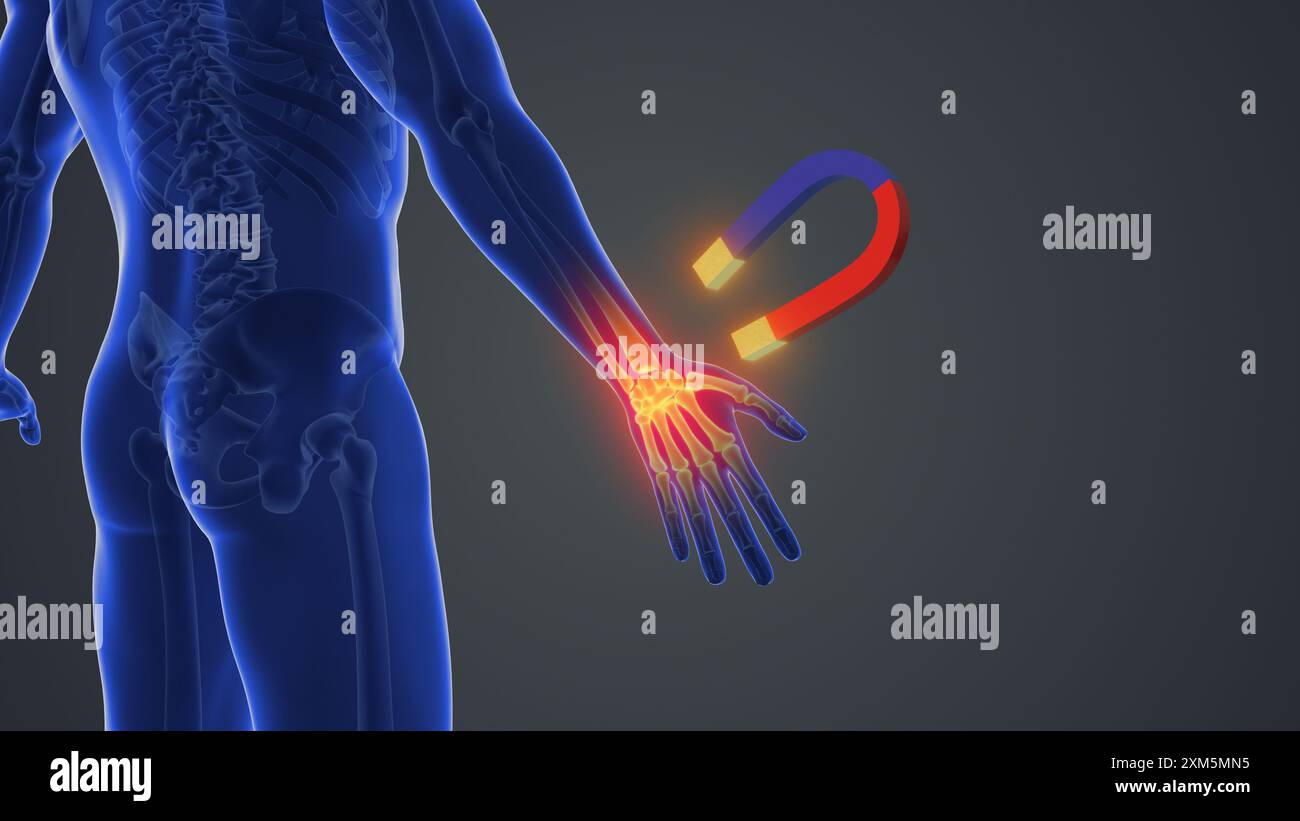 Magnetic field therapy hi-res stock photography and images - Alamy