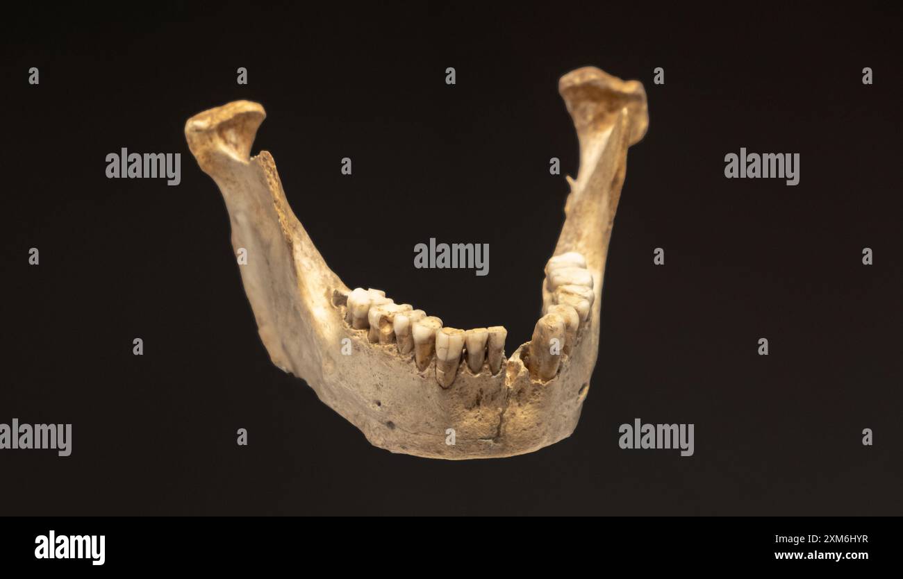 Human jawbone hi-res stock photography and images - Alamy