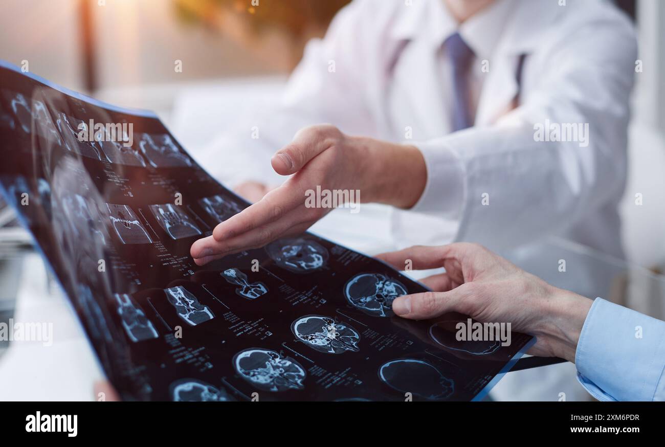 shows the x-ray image to the patient at the reception Stock Photo - Alamy