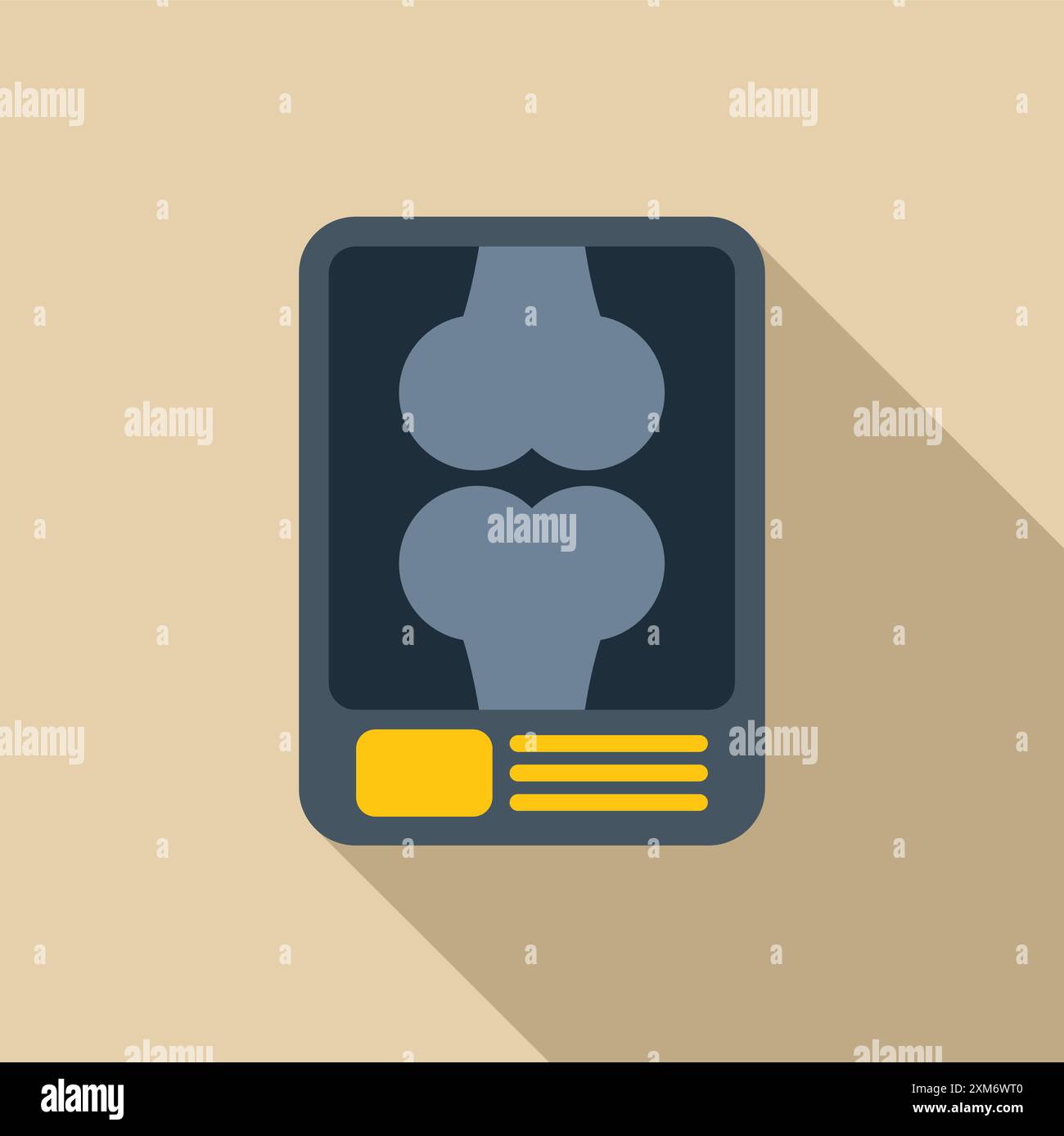 X ray showing bones of the knee joint in orthopedics Stock Vector Image ...