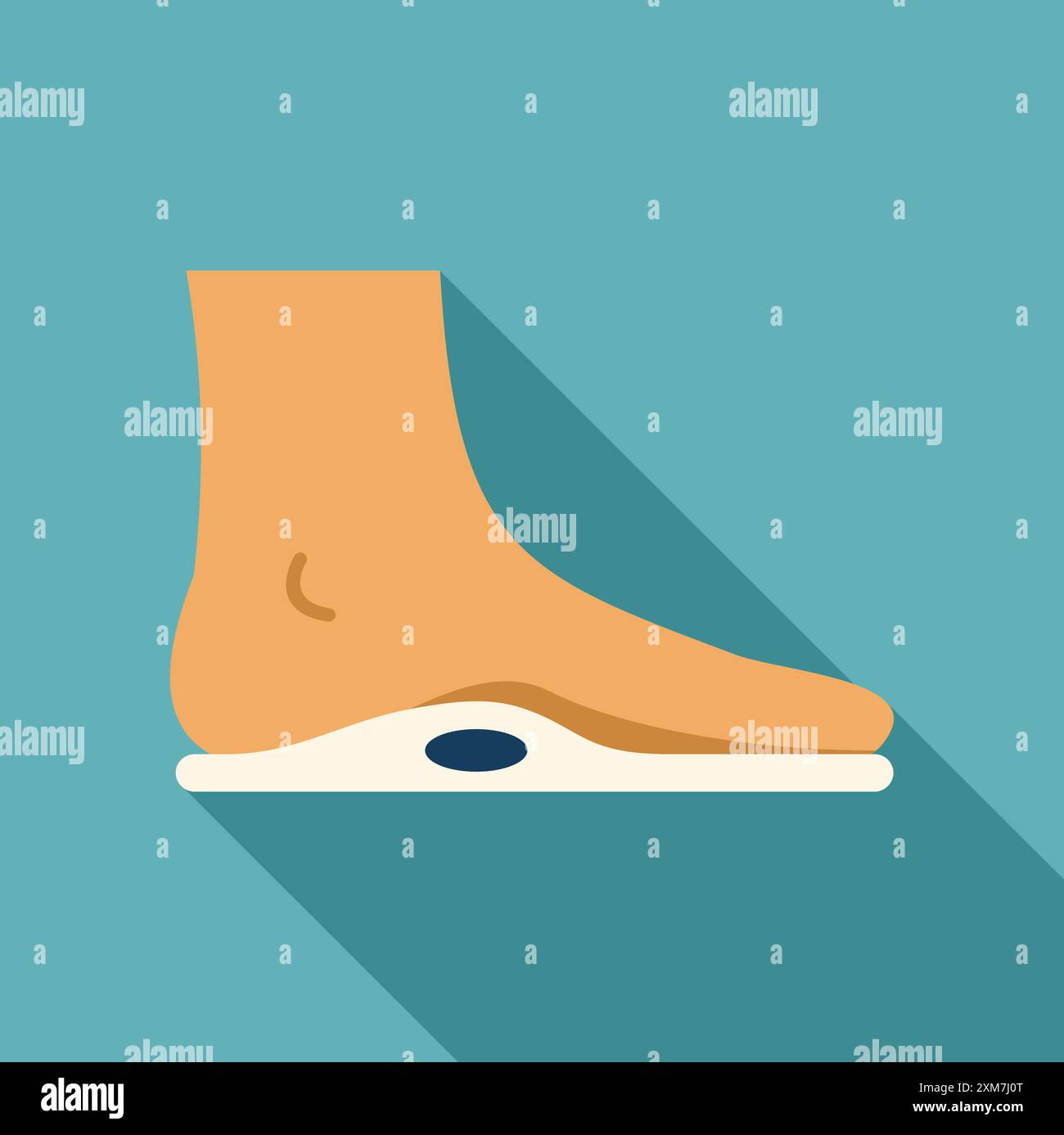 Human foot standing on special orthopedic insole for flatfoot treatment ...