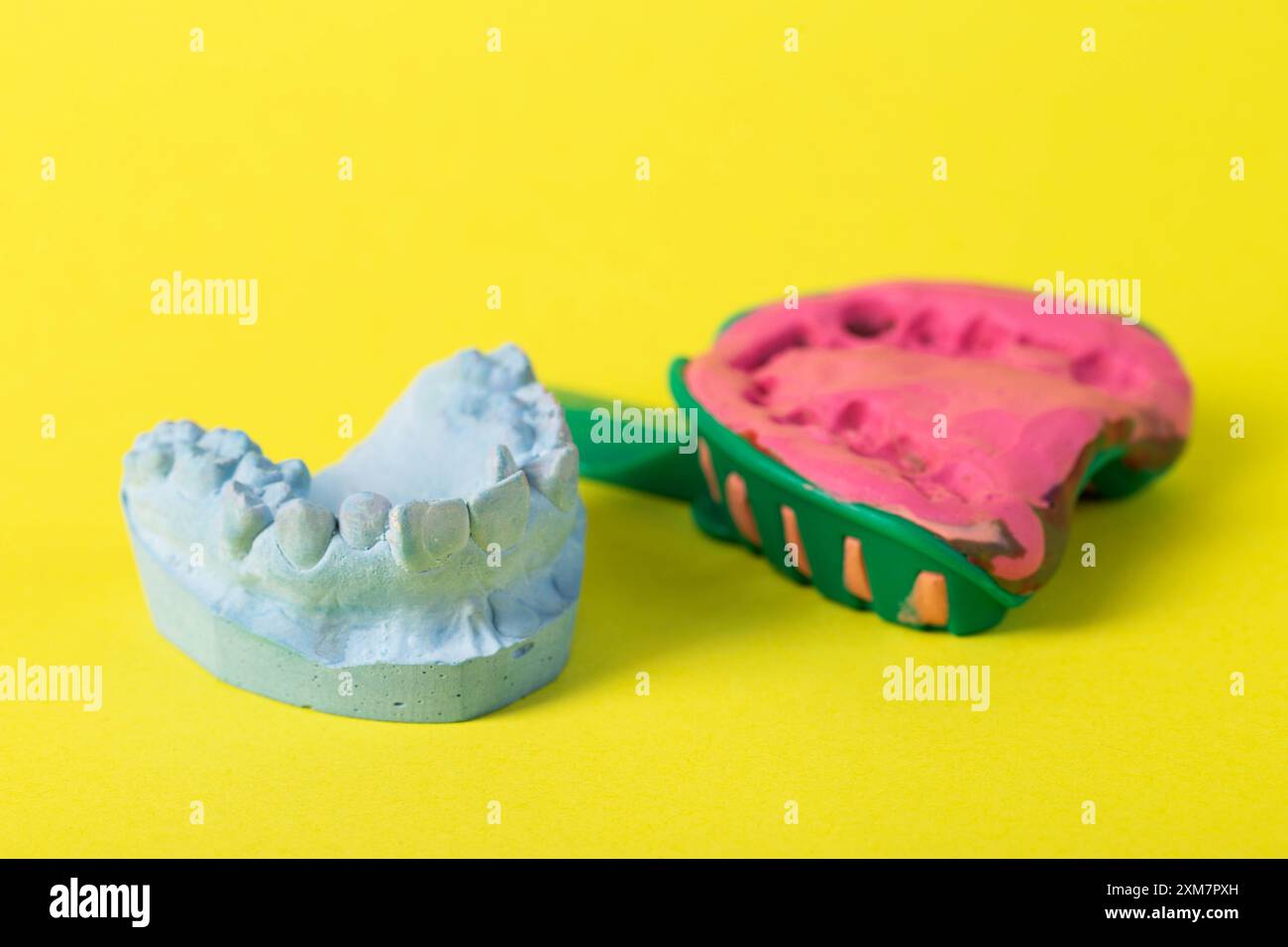 Dental spoon with alginate plastic mass for taking an impression of the ...