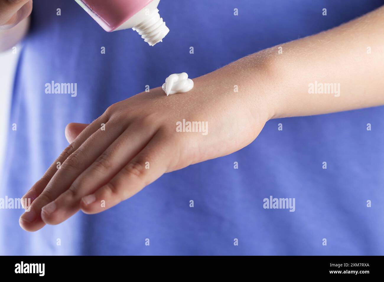 The hands of a girl apply a medicinal cream against chapping of the ...