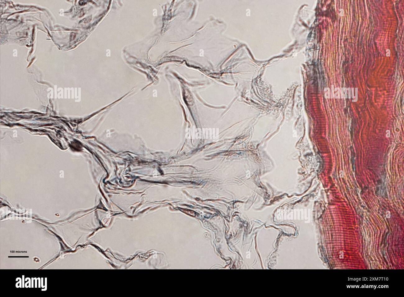adipose (body fat) tissue under a light microscope times 10 ...