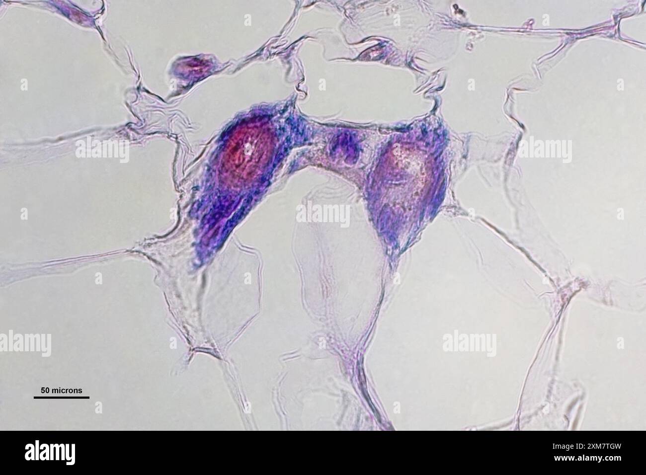 adipose (body fat) tissue under a light microscope times 40 ...
