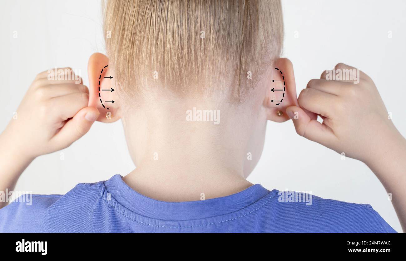 Lop-eared girl holding her ears on a white background. The concept of ...