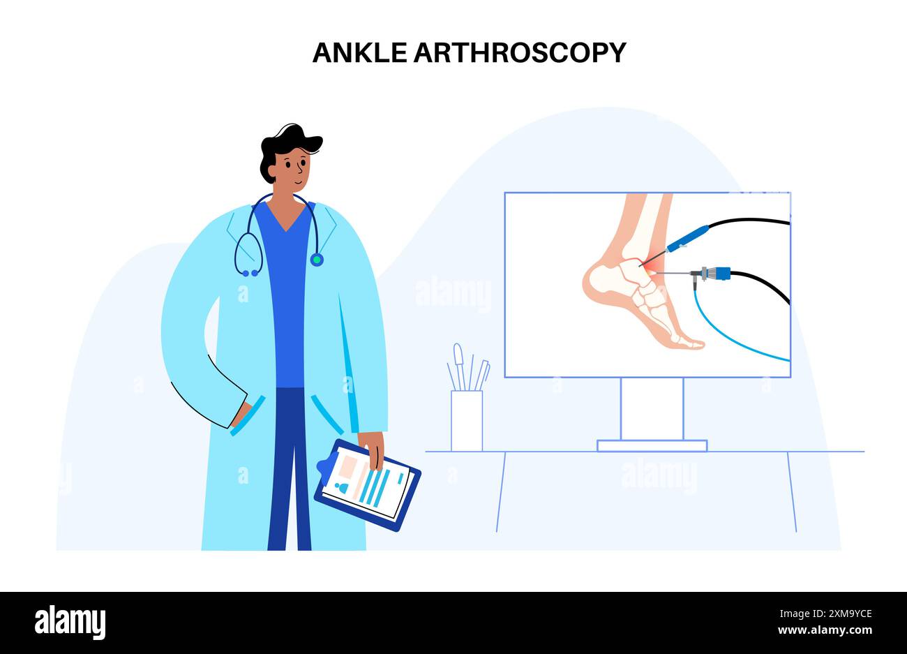 Illustration of an ankle arthroscopy procedure. This is a procedure for ...