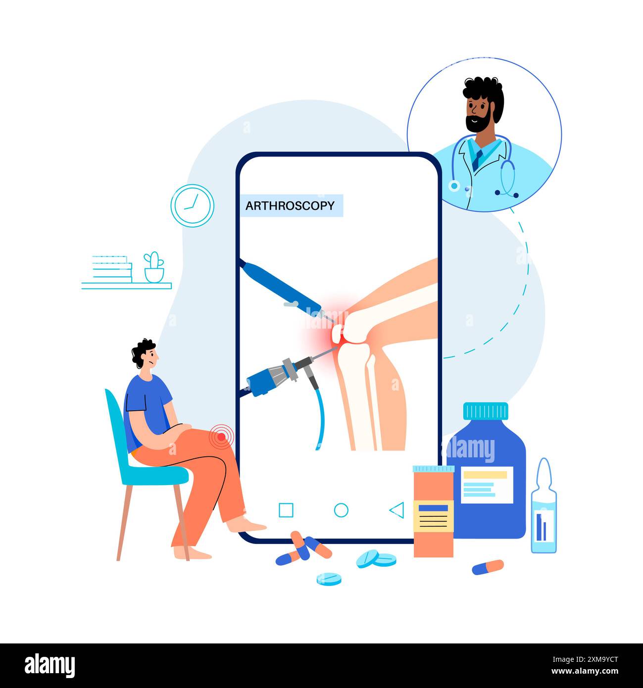 Illustration of knee joint arthroscopy procedure. This is a procedure ...