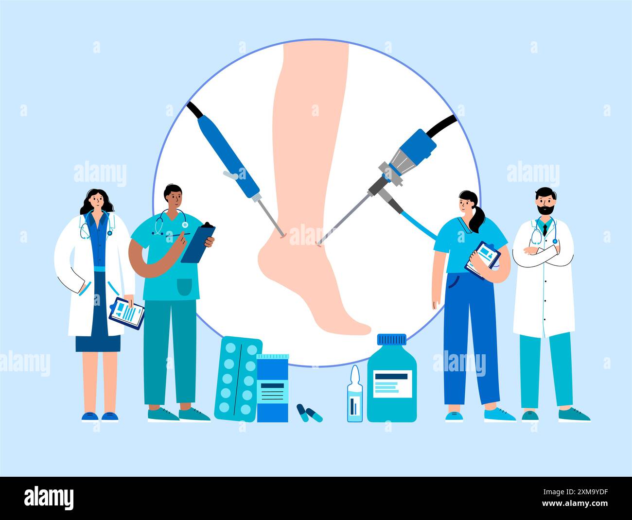 Illustration of an ankle arthroscopy procedure. This is a procedure for ...