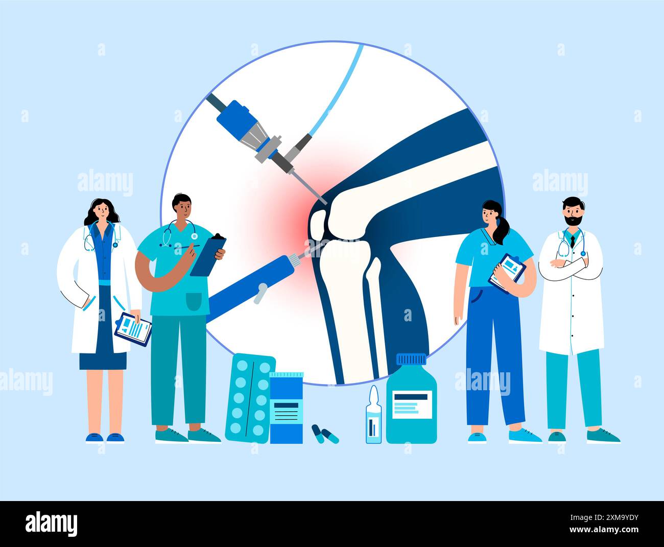 Illustration of knee joint arthroscopy procedure. This is a procedure ...