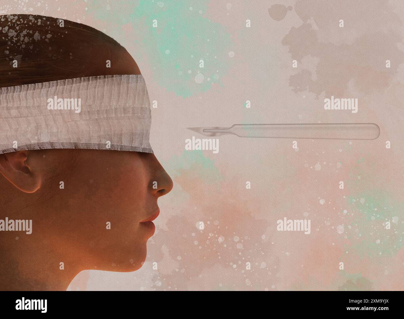 Plastic surgery, conceptual illustration. This is a branch of surgery ...