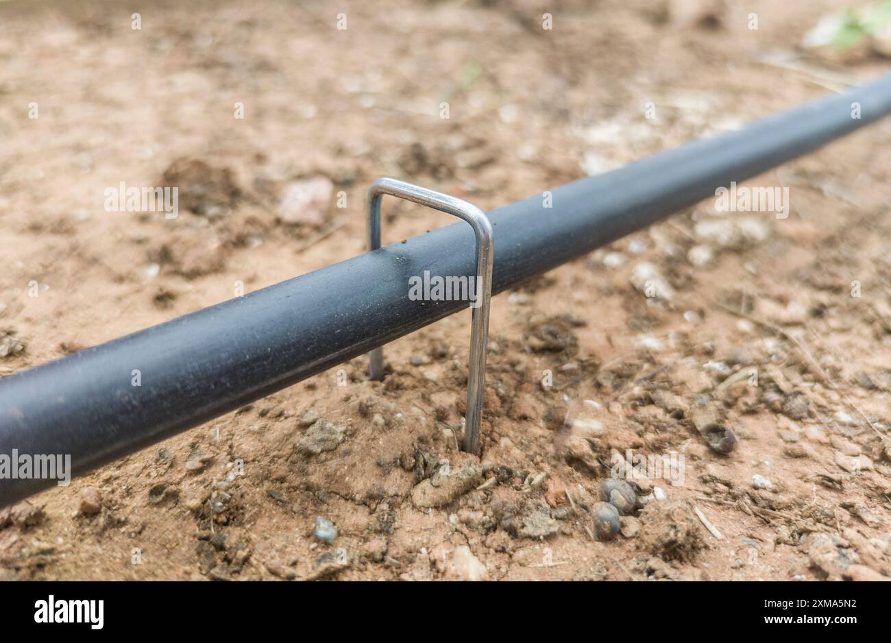 Peg tube hi-res stock photography and images - Alamy