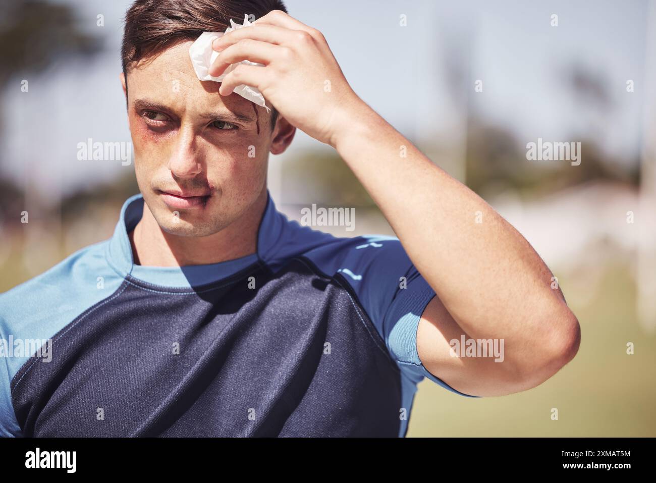 Man, athlete and rugby or sports injury on face for physical and tough ...