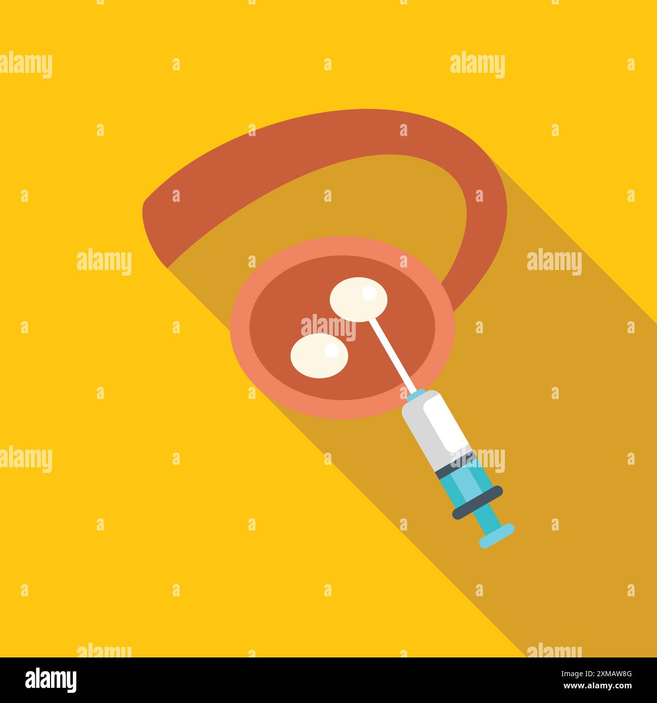 Syringe being used to remove egg cell from ovary for in vitro ...