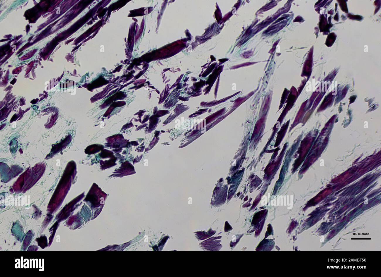 Muscle natural patterns hi-res stock photography and images - Alamy