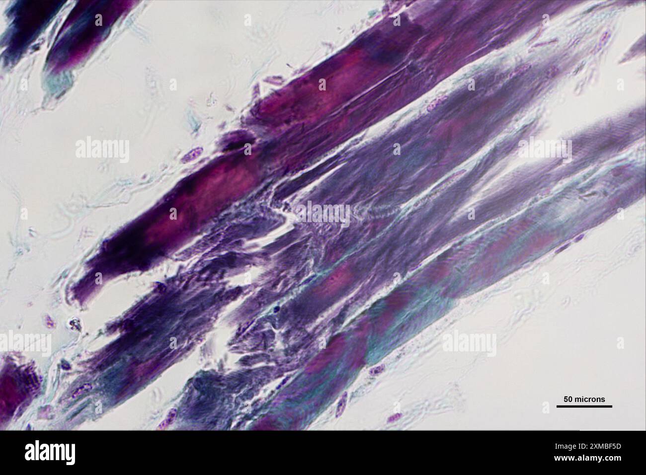 striated muscle in longitudinal section at times 40 magnification Stock ...
