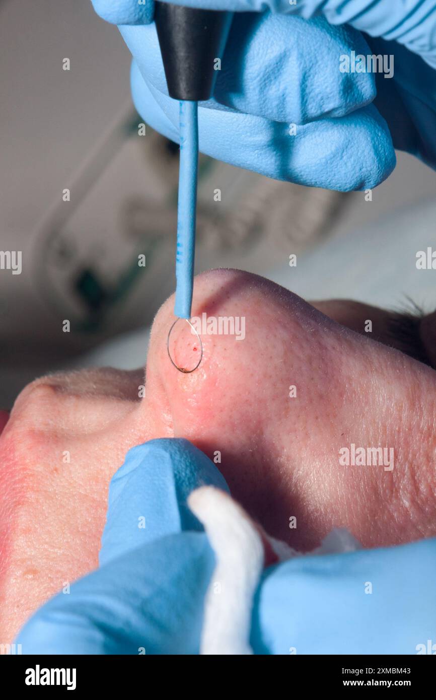 Closeup of hand of surgeon at work using medical instrument for ...
