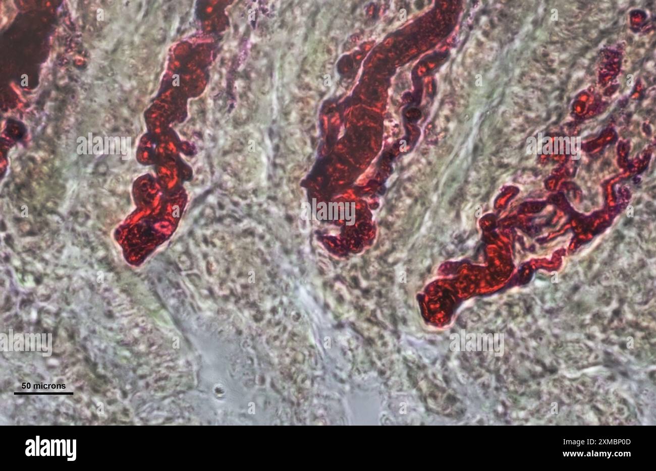 Small intestine injected transverse section under a light microscope ...