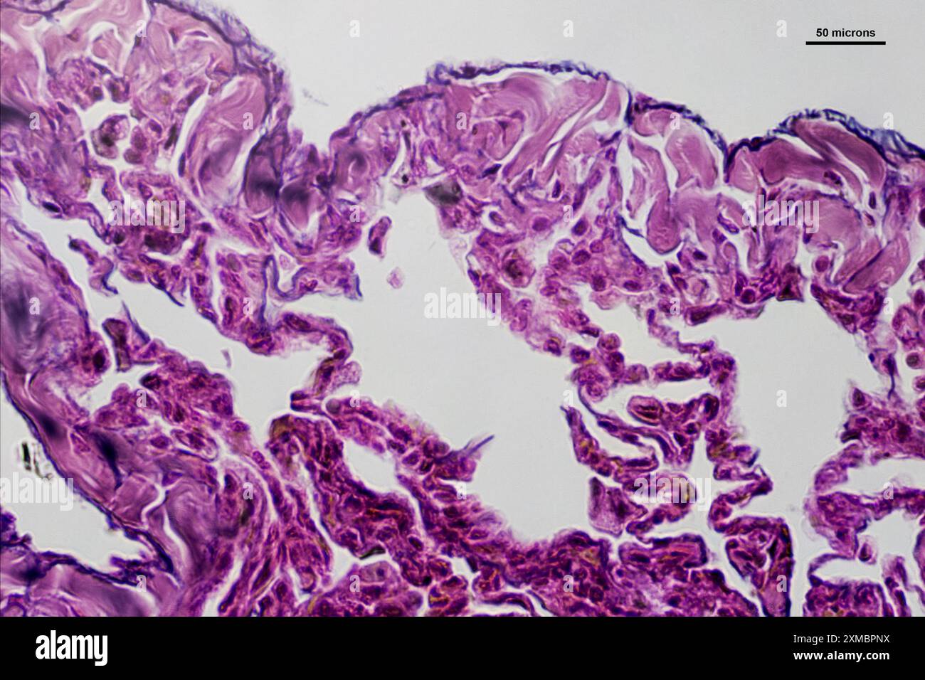 lung in transversion under a light microscope at times 40 magnification ...