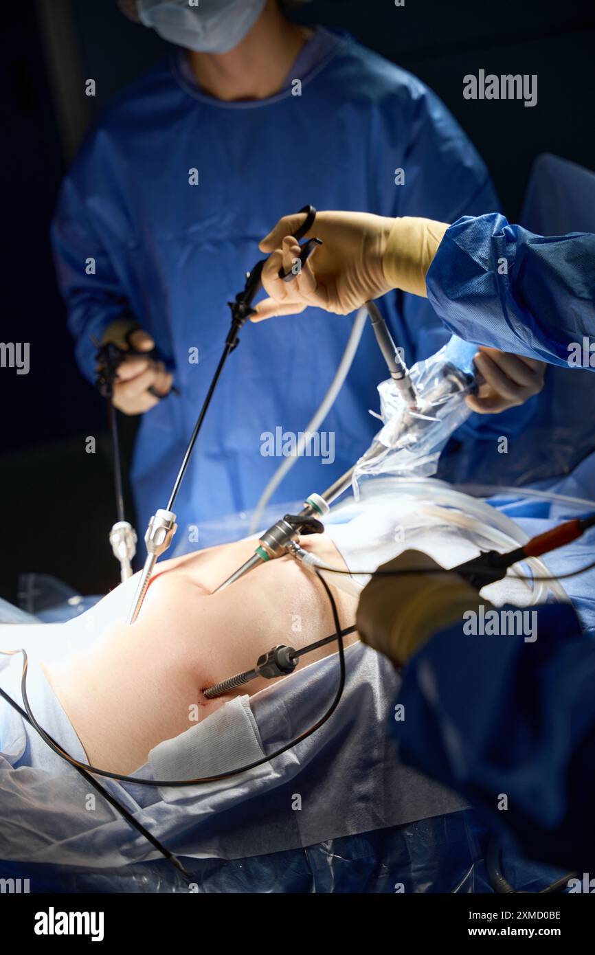 Doctor conducting laparoscopic operation on an abdominal cavity Stock ...
