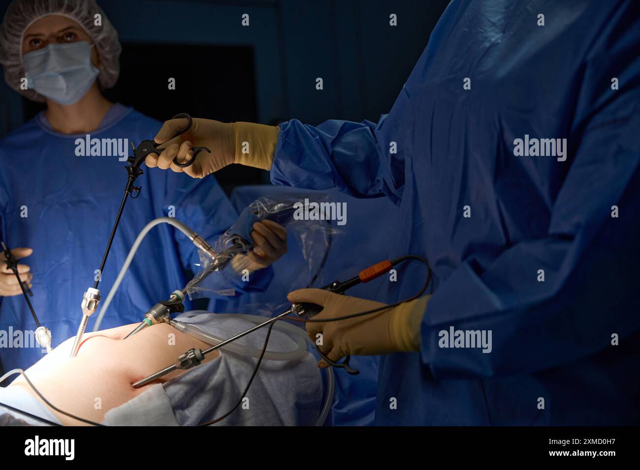 Surgeons team hands during laparoscopic abdominal operation in patient ...