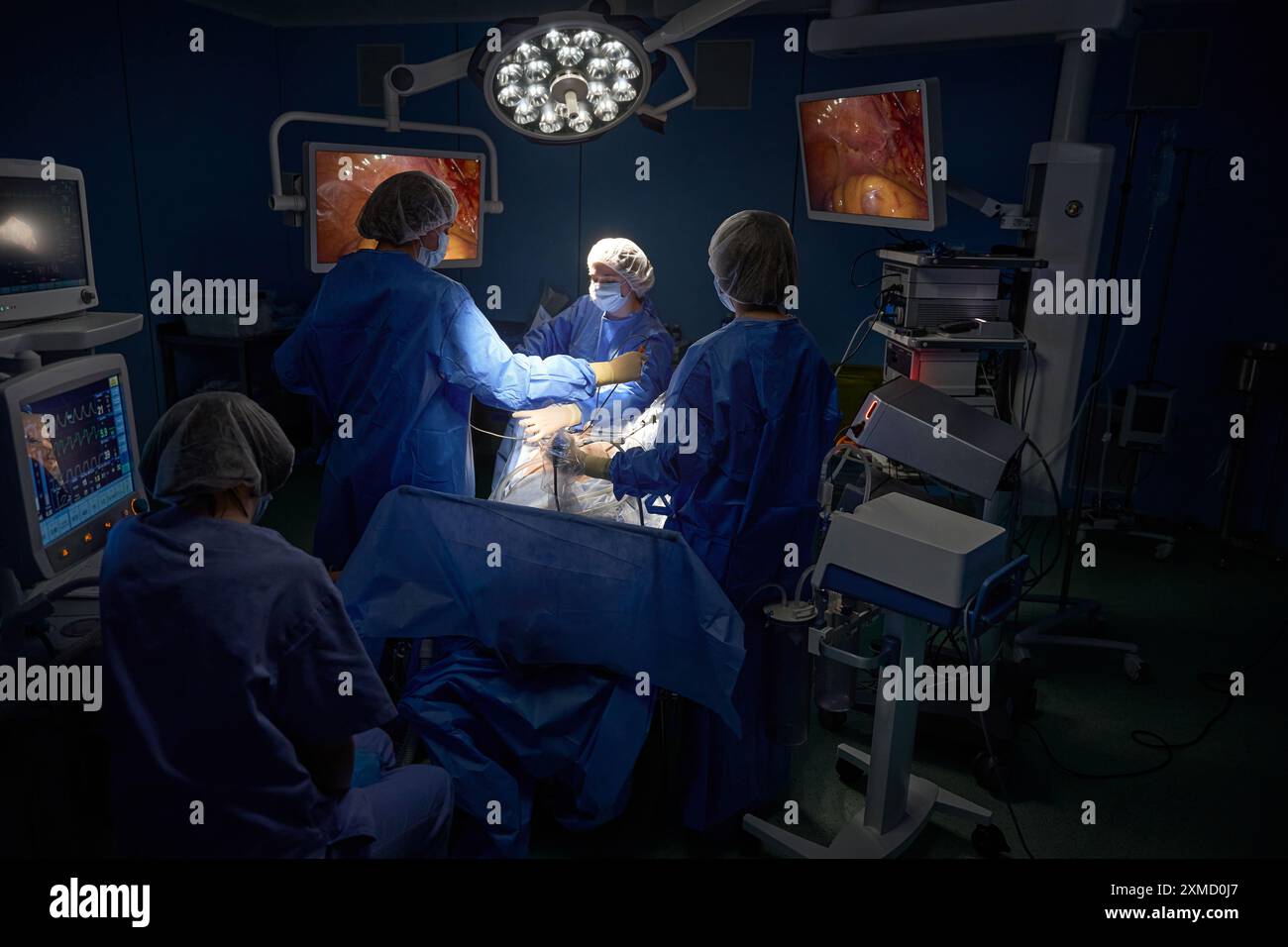 Internal organ of patient seen on computer monitor during laparoscopic ...