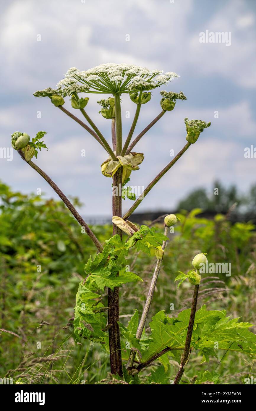 Phototoxic reaction hi-res stock photography and images - Alamy