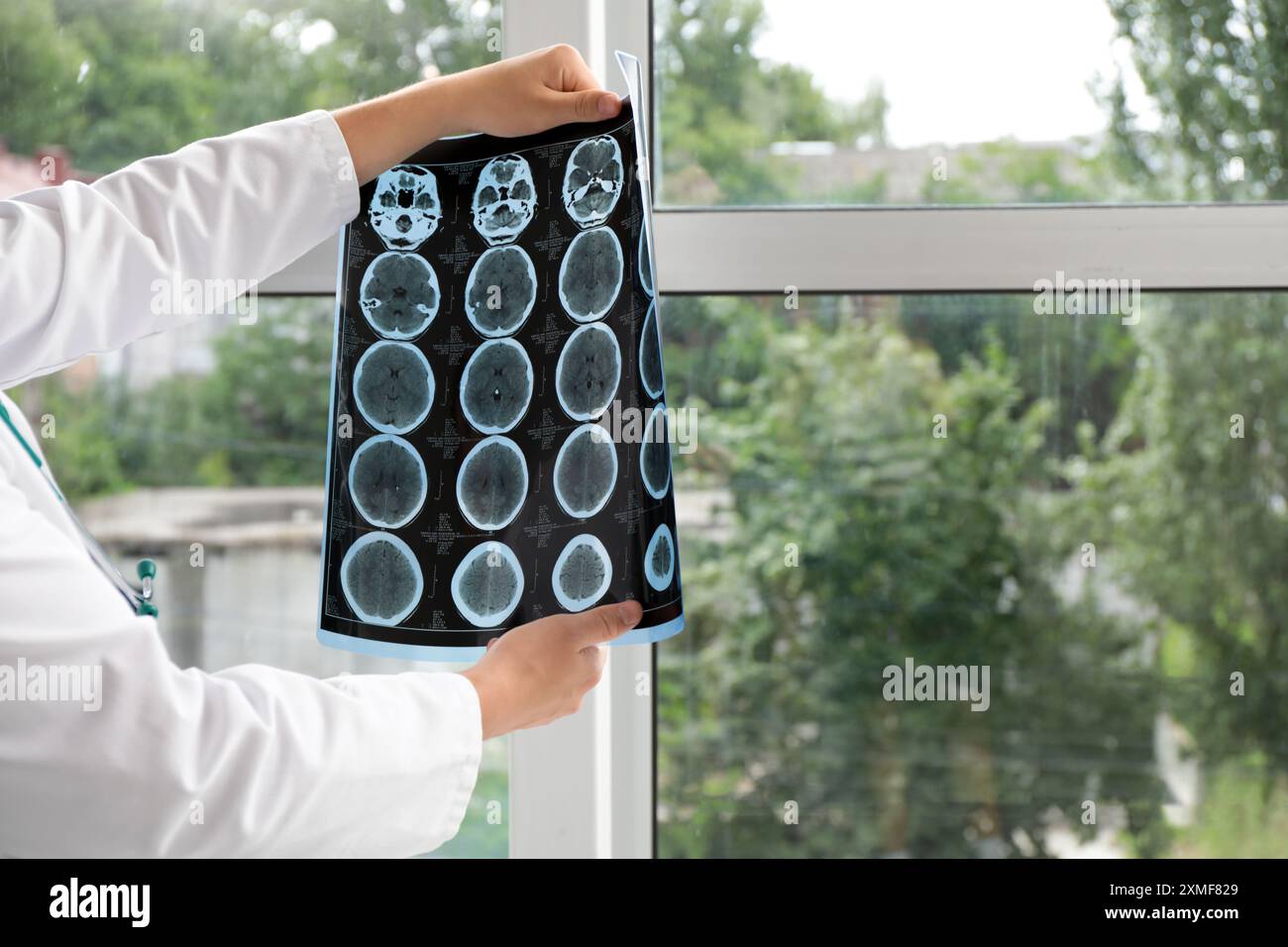 Male doctor studying MRI scan near window in clinic, closeup Stock ...