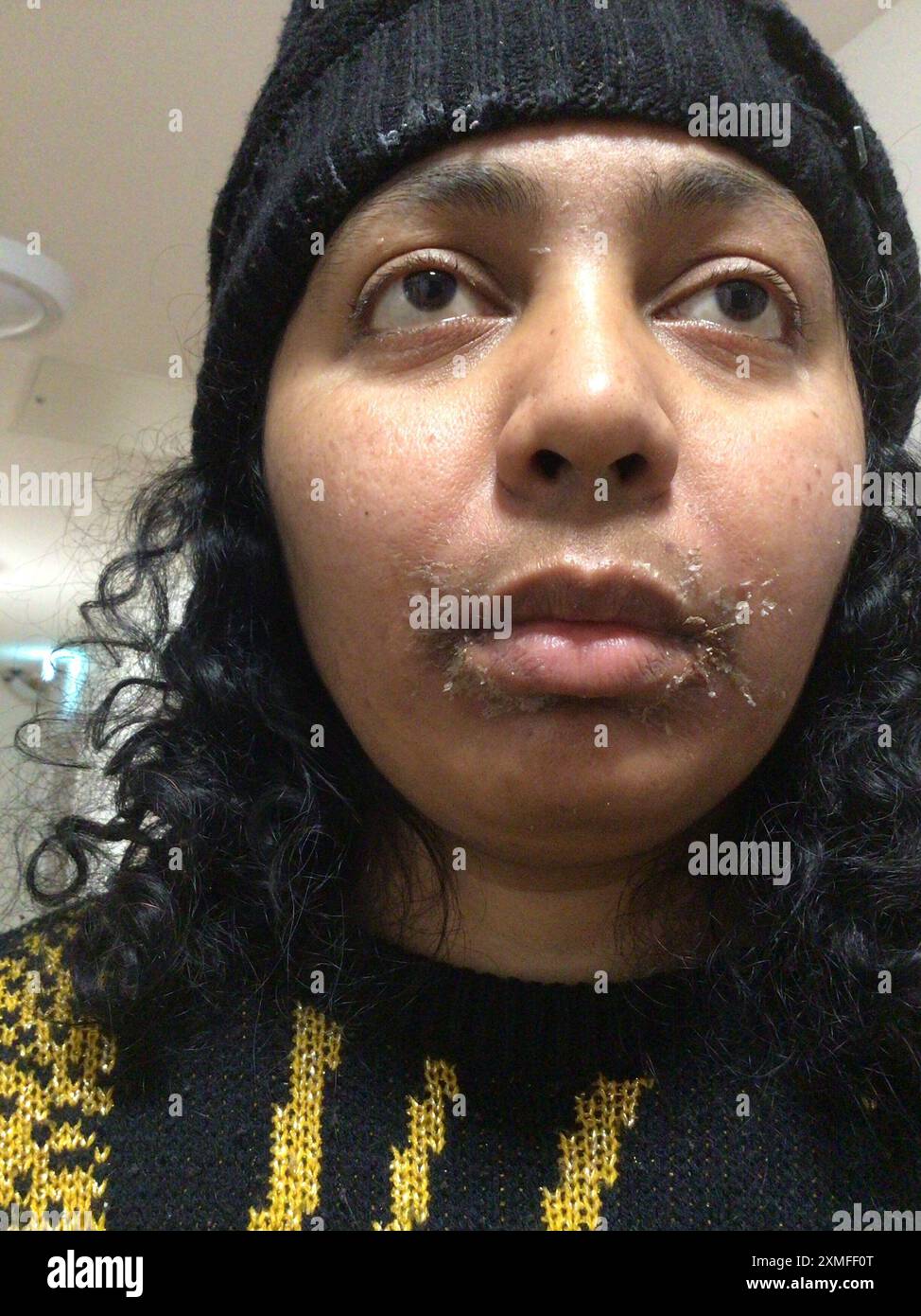 England, London, Central Middlesex Hospital, Pond Ward, Mental Health ...