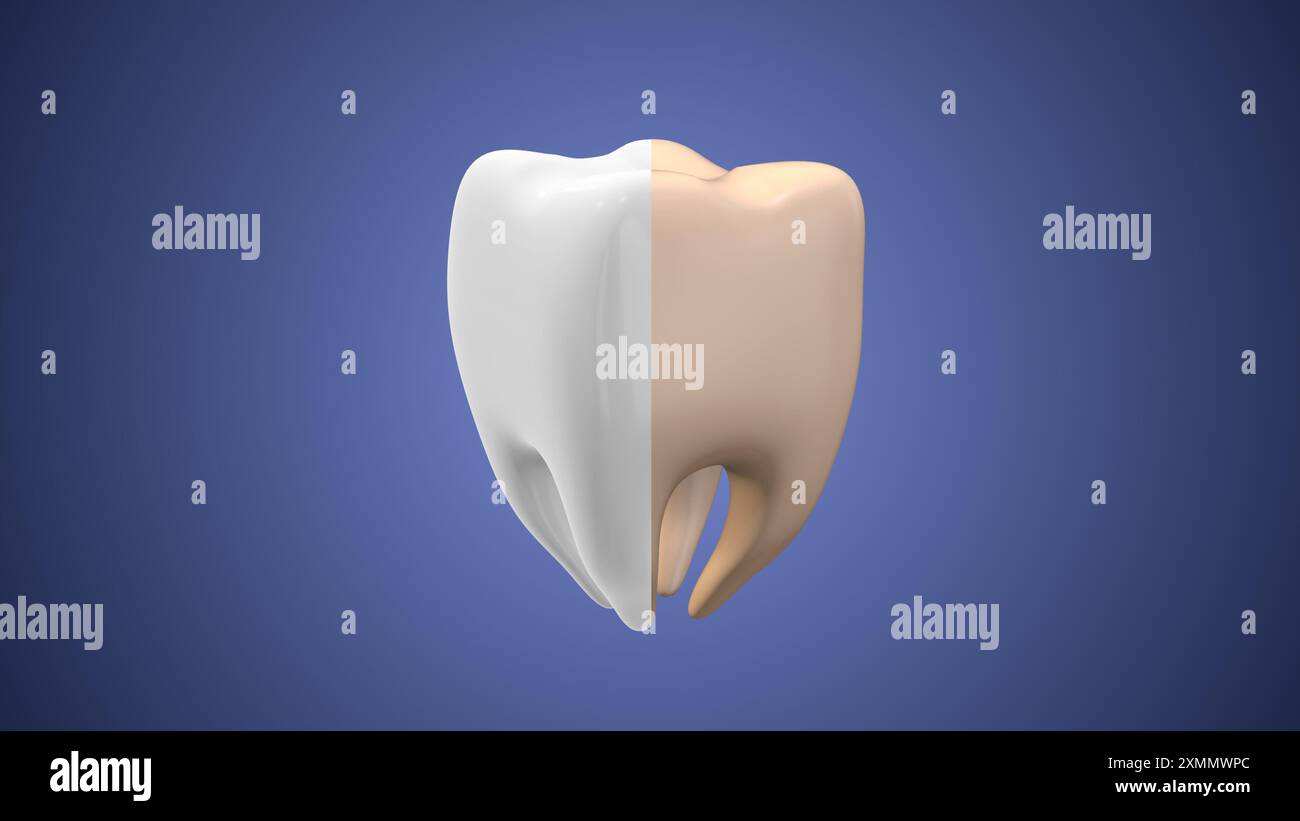 Medical animation of the healthy and yellow tooth Stock Photo - Alamy
