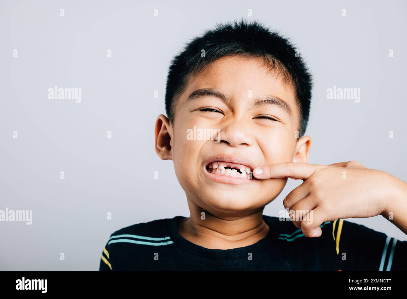 Asian boy showcasing dentistry pointing to missing front tooth. Health ...