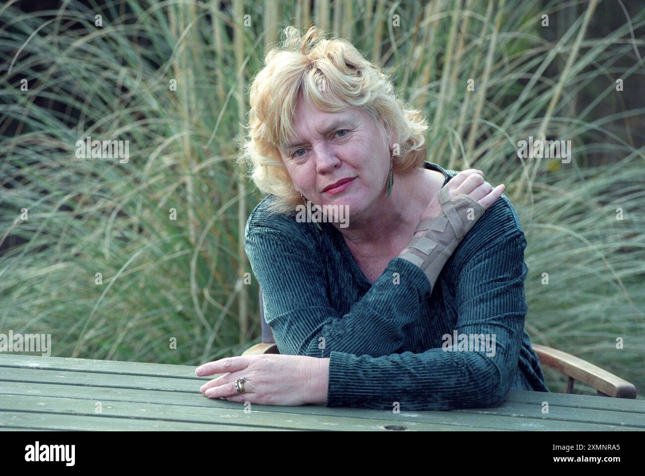 Jan Millington ???Broken wrist ??? 6 March 1999 Picture by Roger Bamber ...