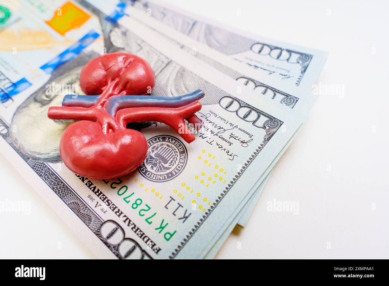 Kidney model positioned on a pile of cash isolated on a neutral ...