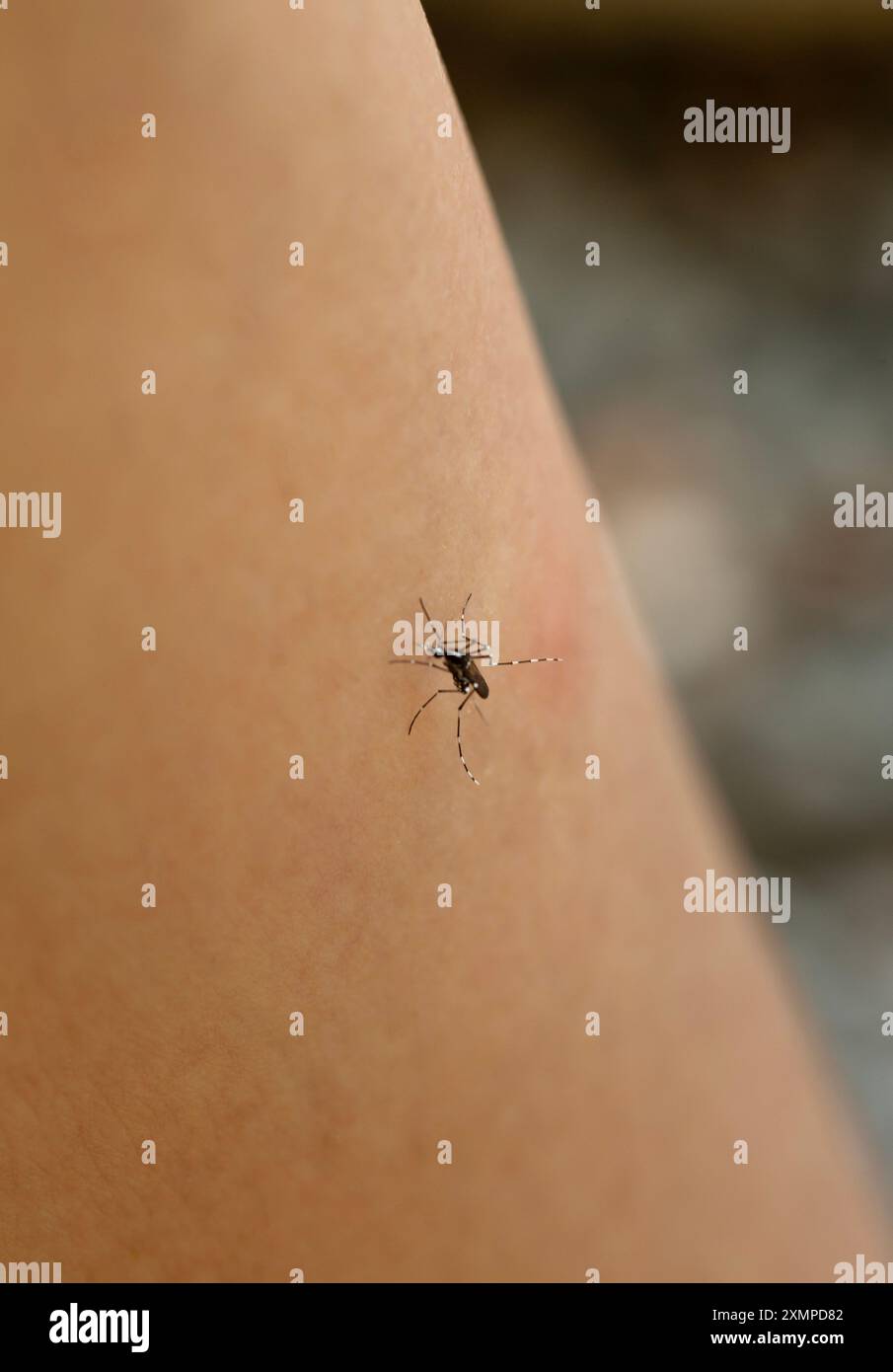 Tiger mosquito bites a man's leg. Defocused Stock Photo - Alamy