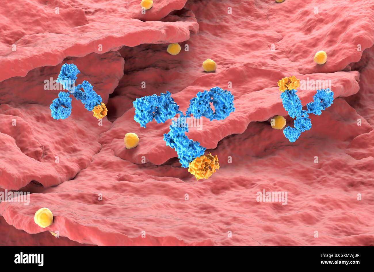 Monoclonal antibody therapy in Psoriasis - closeup view 3d illustration ...