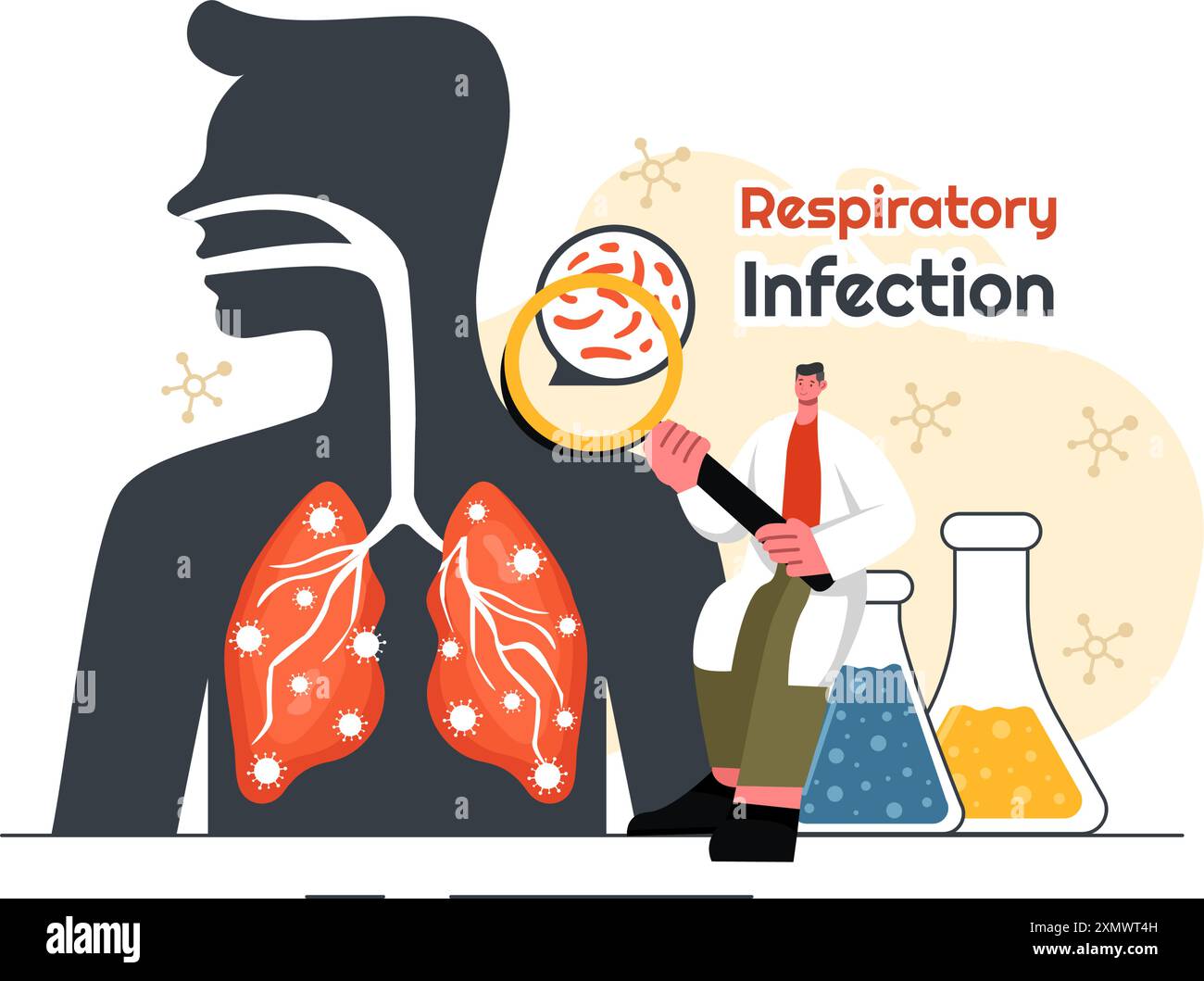 Vector Illustration of Respiratory Infection and Inflammation in the ...