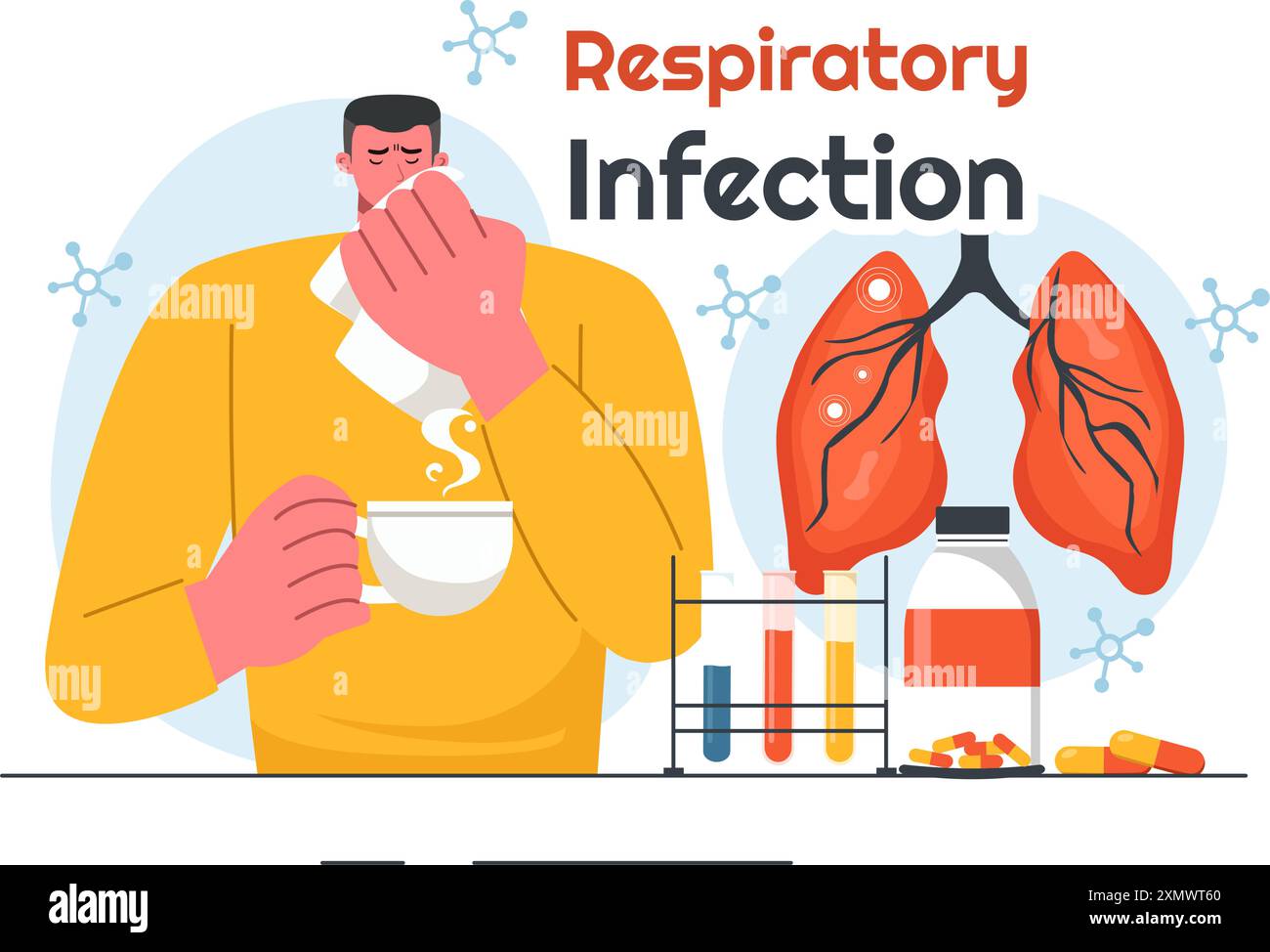 Vector Illustration of Respiratory Infection and Inflammation in the ...