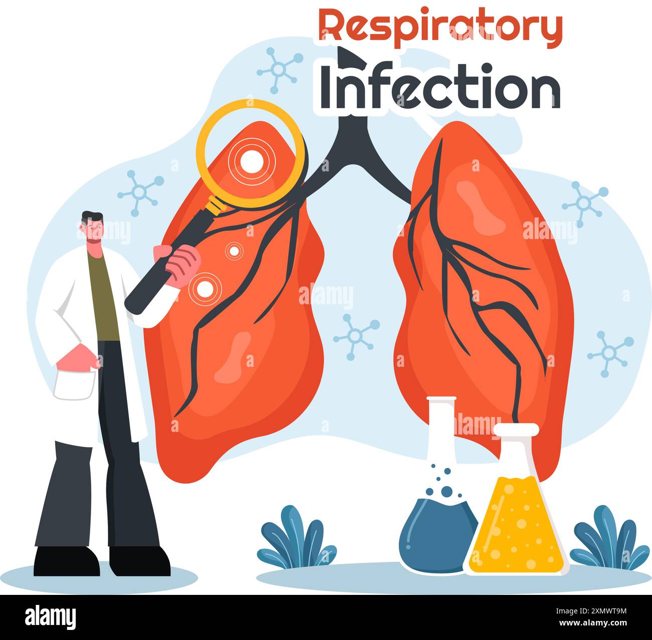 Vector Illustration of Respiratory Infection and Inflammation in the ...