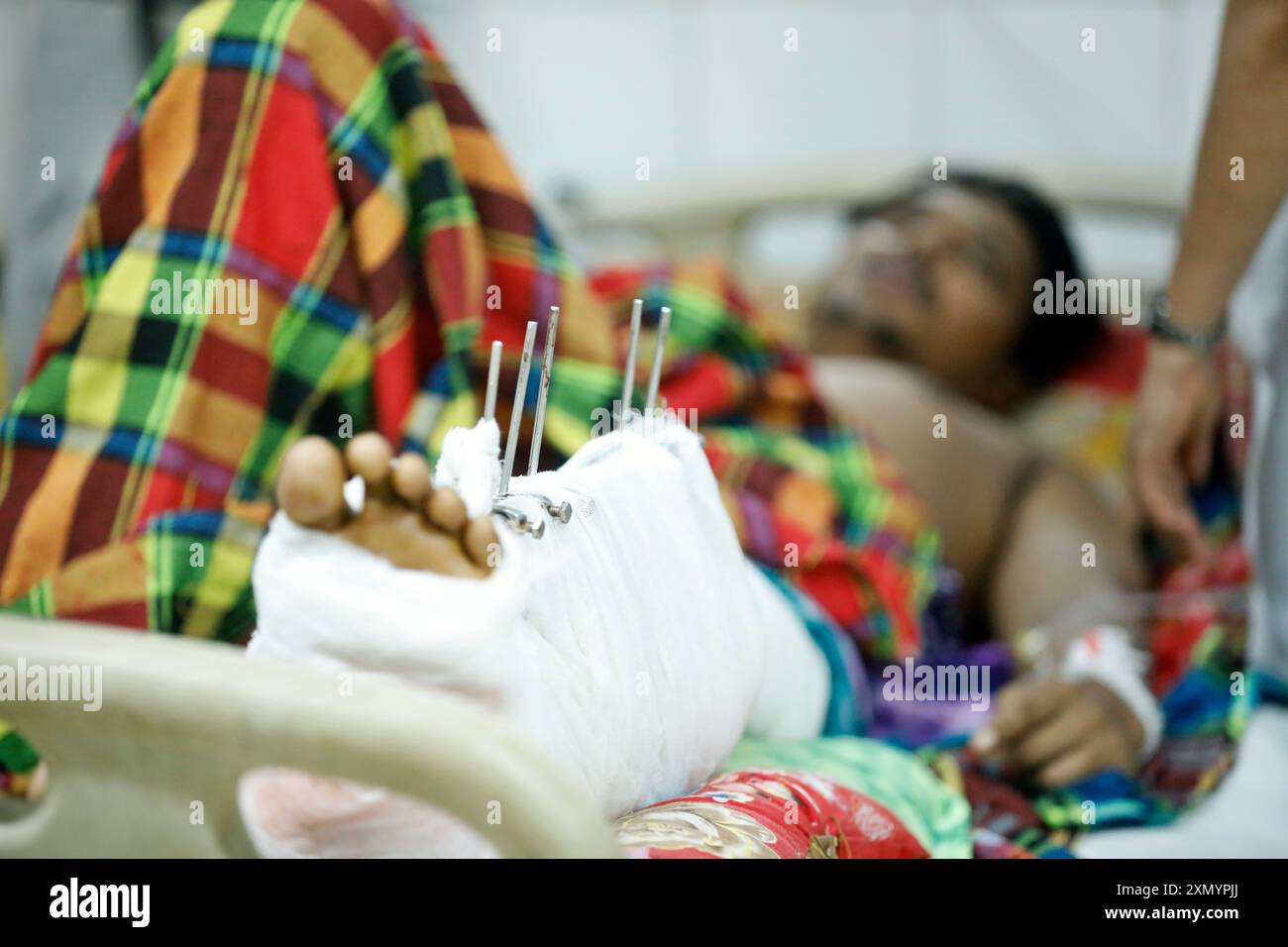 Dhaka, Bangladesh - July 30, 2024: Dhaka's National Orthopedic Hospital ...