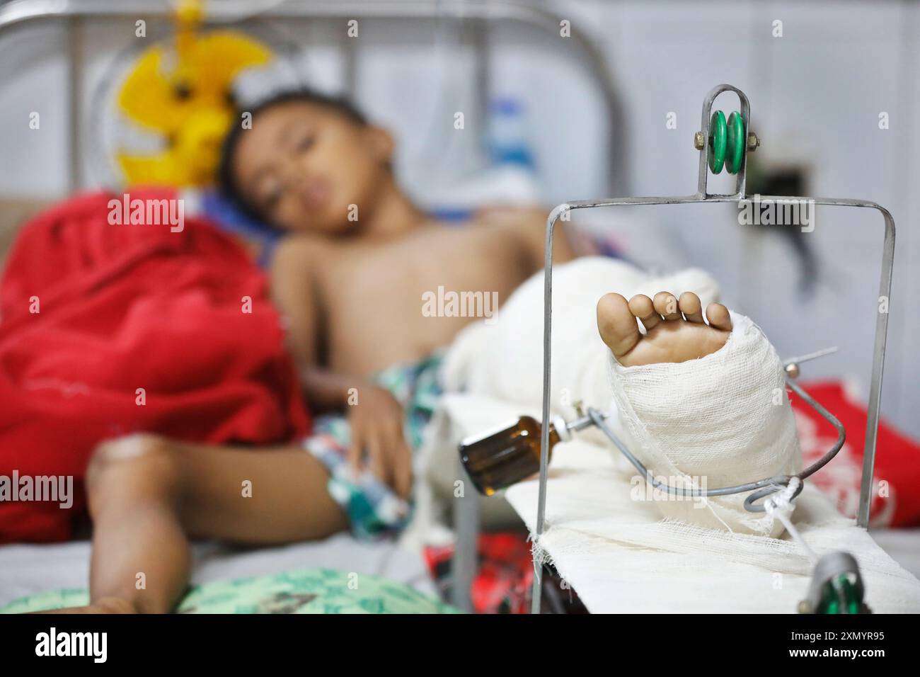 Dhaka, Bangladesh - July 30, 2024: Dhaka's National Orthopedic Hospital ...