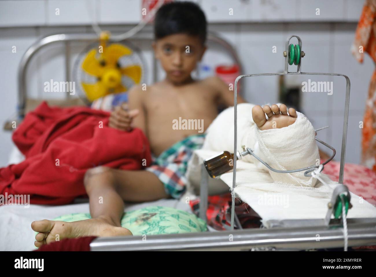 Dhaka, Bangladesh - July 30, 2024: Dhaka's National Orthopedic Hospital ...