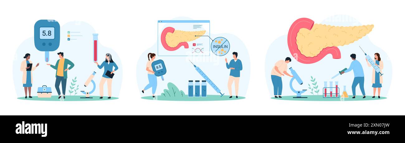 Diagnosis and treatment of pancreatic diseases set. Tiny people with ...