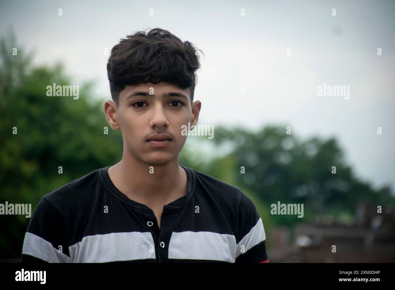 eye flu, acute conjunctivitis patient, asian patient has red eyes and ...