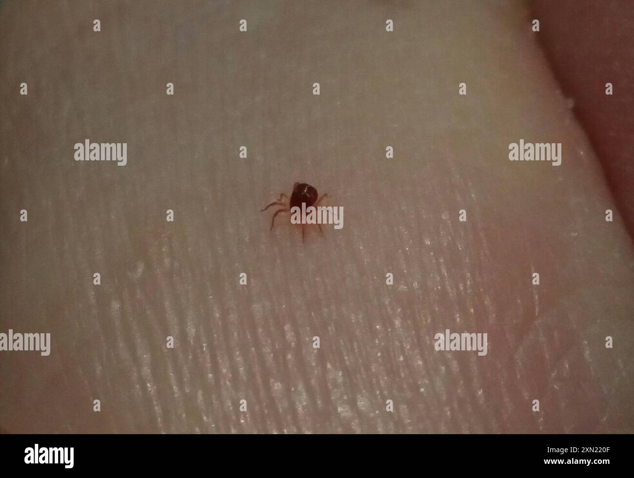 Mites and Ticks (Acari) Arachnida Stock Photo - Alamy