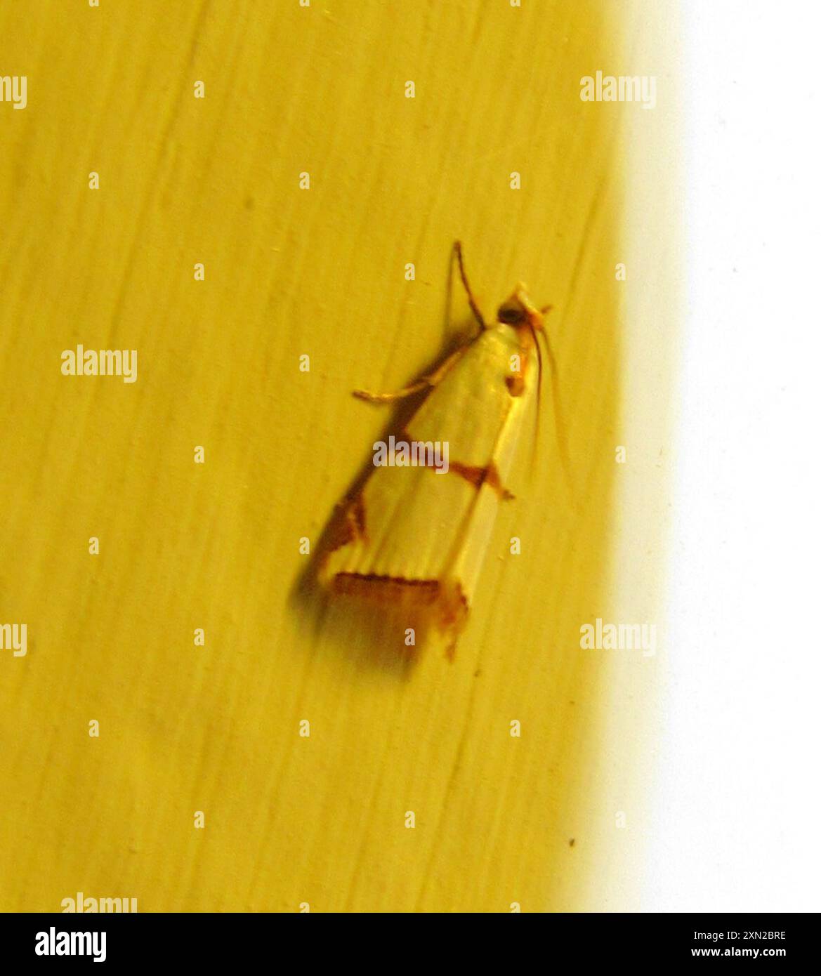 Argyria hi-res stock photography and images - Alamy