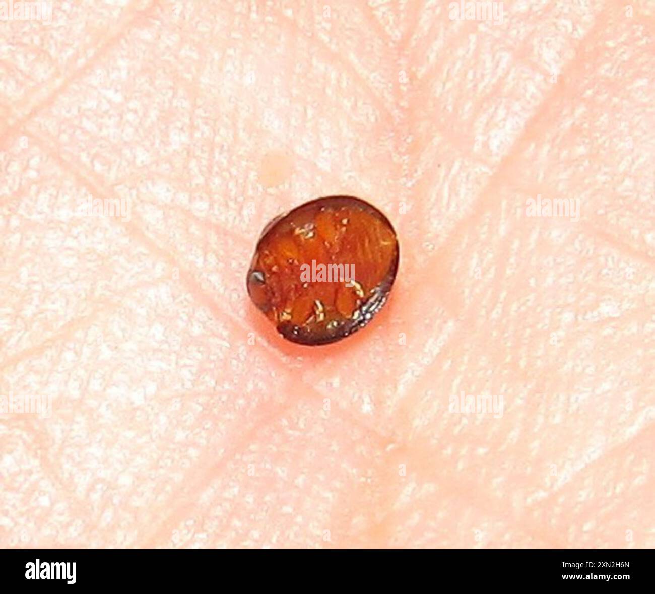 Scale-feeding Lady Beetles (Chilocorinae) Insecta Stock Photo - Alamy