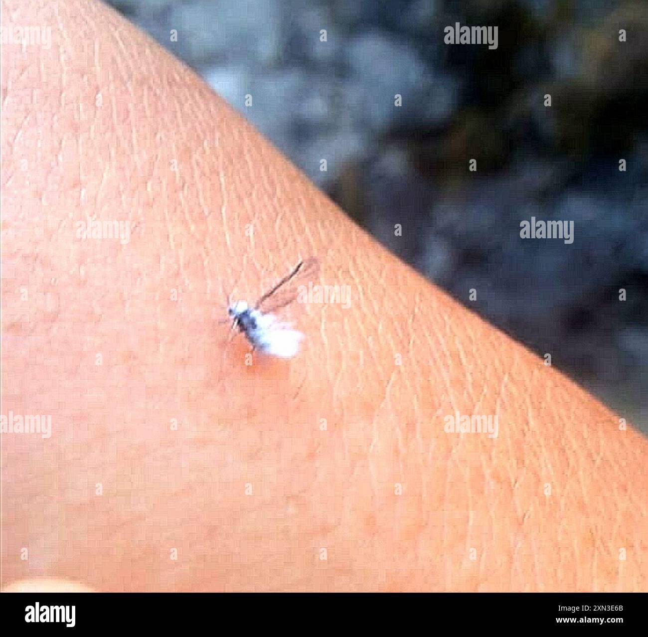 Woolly Aphids and Gall-making Aphids (Eriosomatinae) Insecta Stock ...