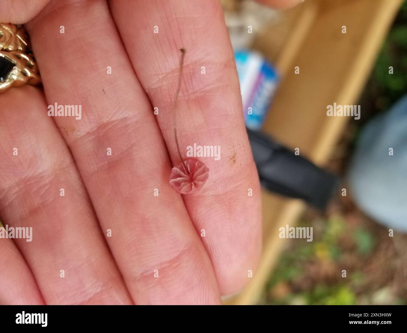 Haematocephalus hi-res stock photography and images - Alamy