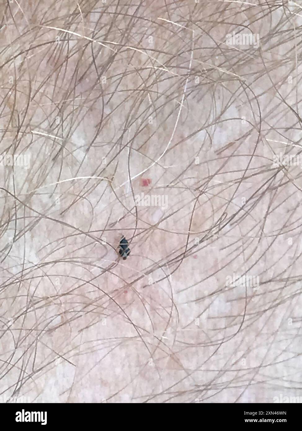 Minute pirate bugs (Anthocoridae) Insecta Stock Photo - Alamy